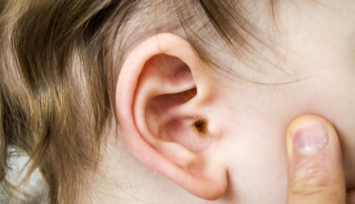 Otite: tutto quello che c’è da sapere - Uppa