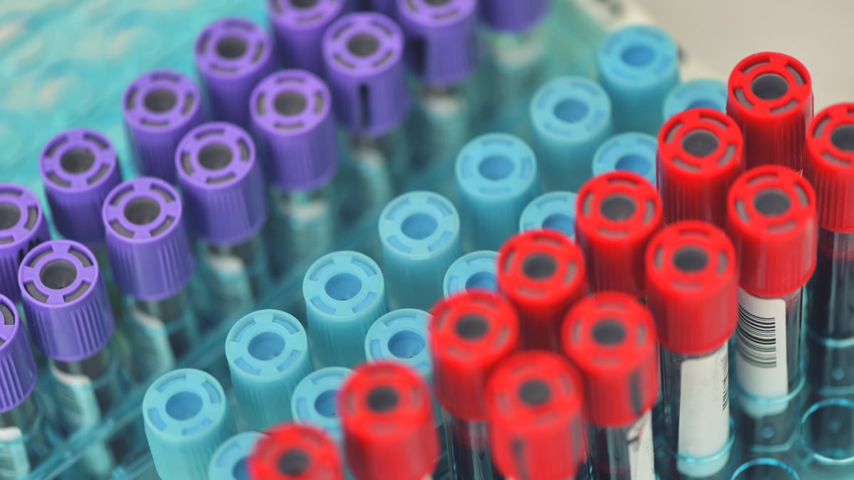 Test del DNA fetale (NIPT): moda o necessità? - Uppa