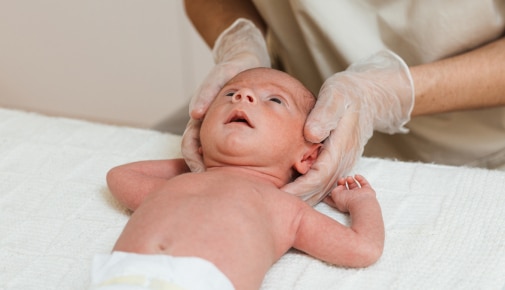 Testa piatta del neonato, cos’è la plagiocefalia? - Uppa