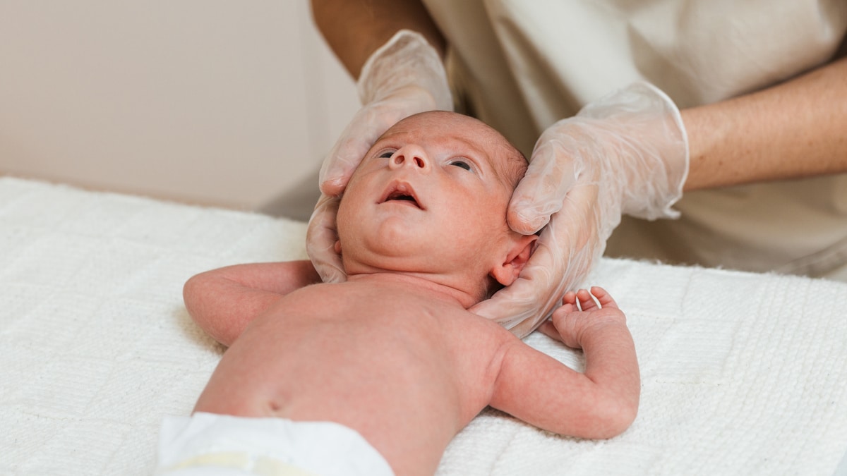 Testa piatta del neonato, cos’è la plagiocefalia? - Uppa